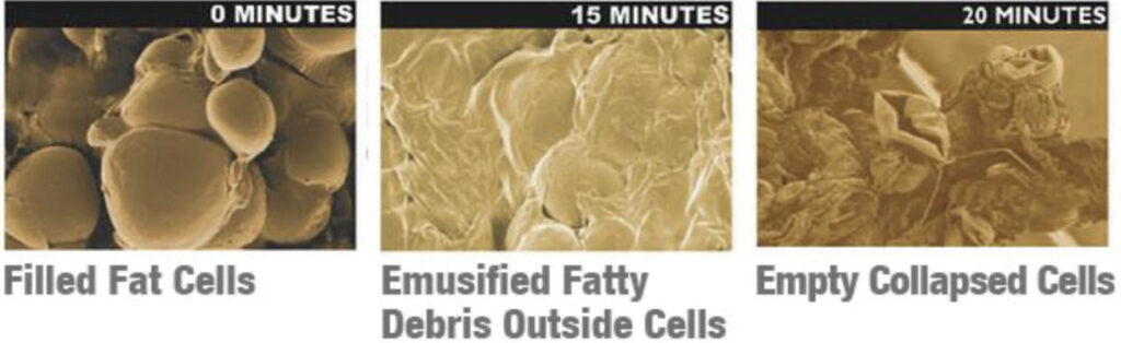 Red Light Therapy Weight Loss | Glastonbury CT | D-Fine Wellness